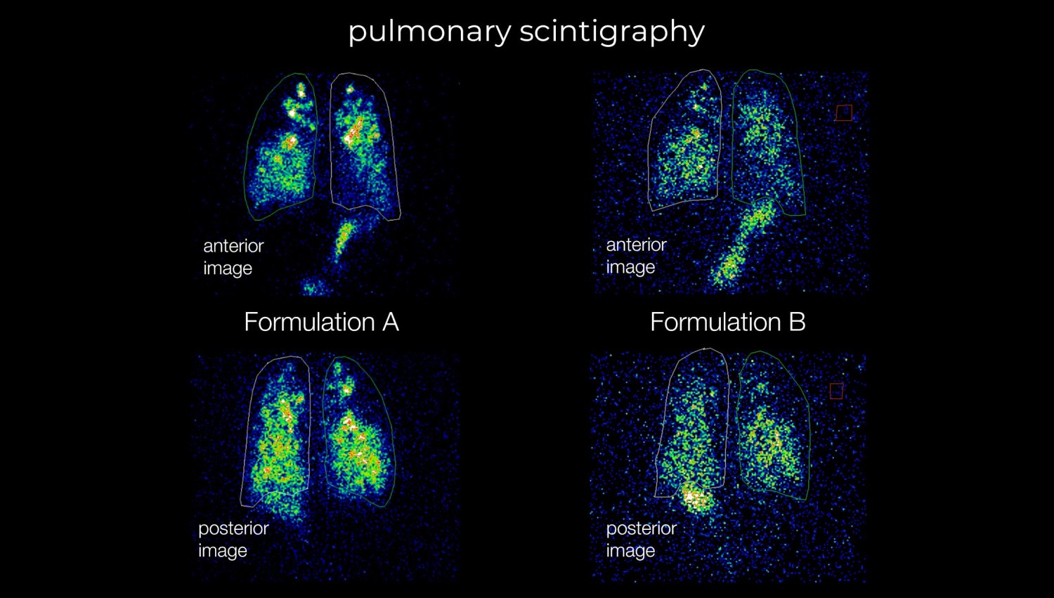 Gamma Scintigraphy Imaging Services & Scintigraphic Studies
